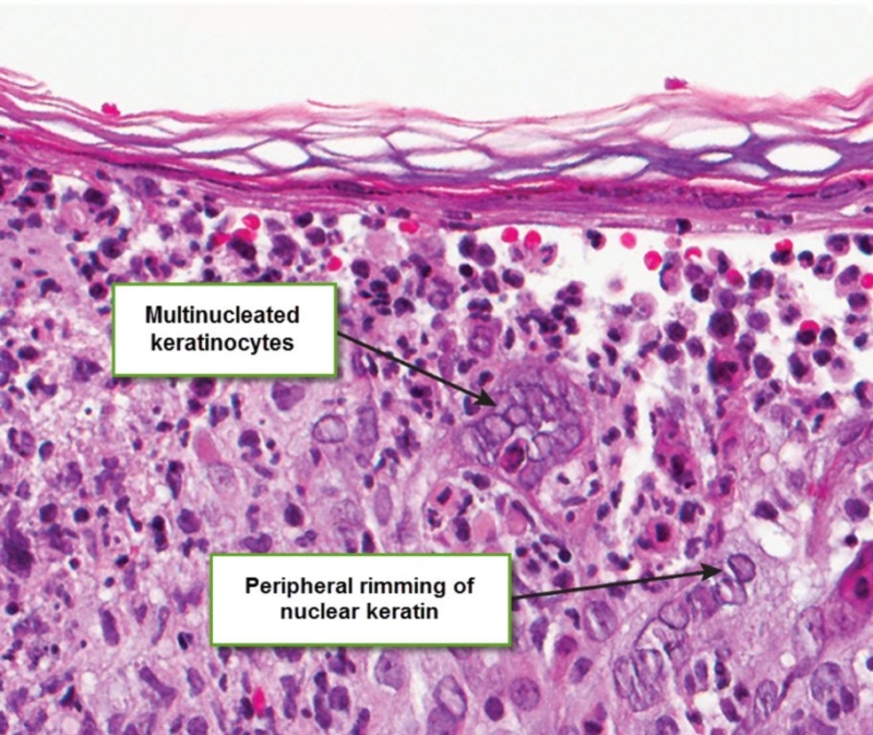 The Dermatopathology Courses – Aid Educational